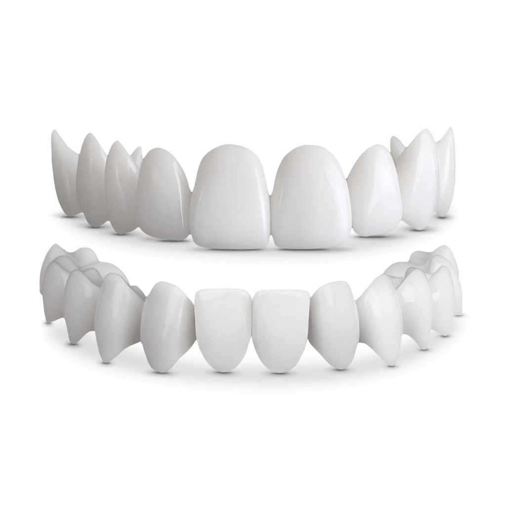 Shiny Smile Veneers | Natural-Looking Snap-On Veneers