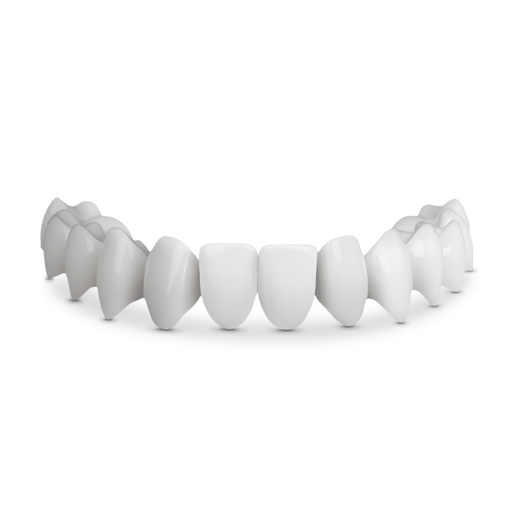 Shiny Smile Veneers | Natural-Looking Snap-On Veneers